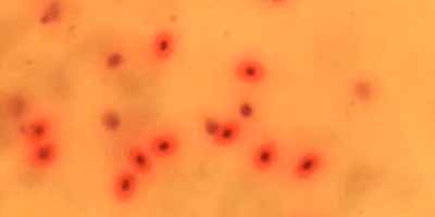 Online observation | eLearnEver